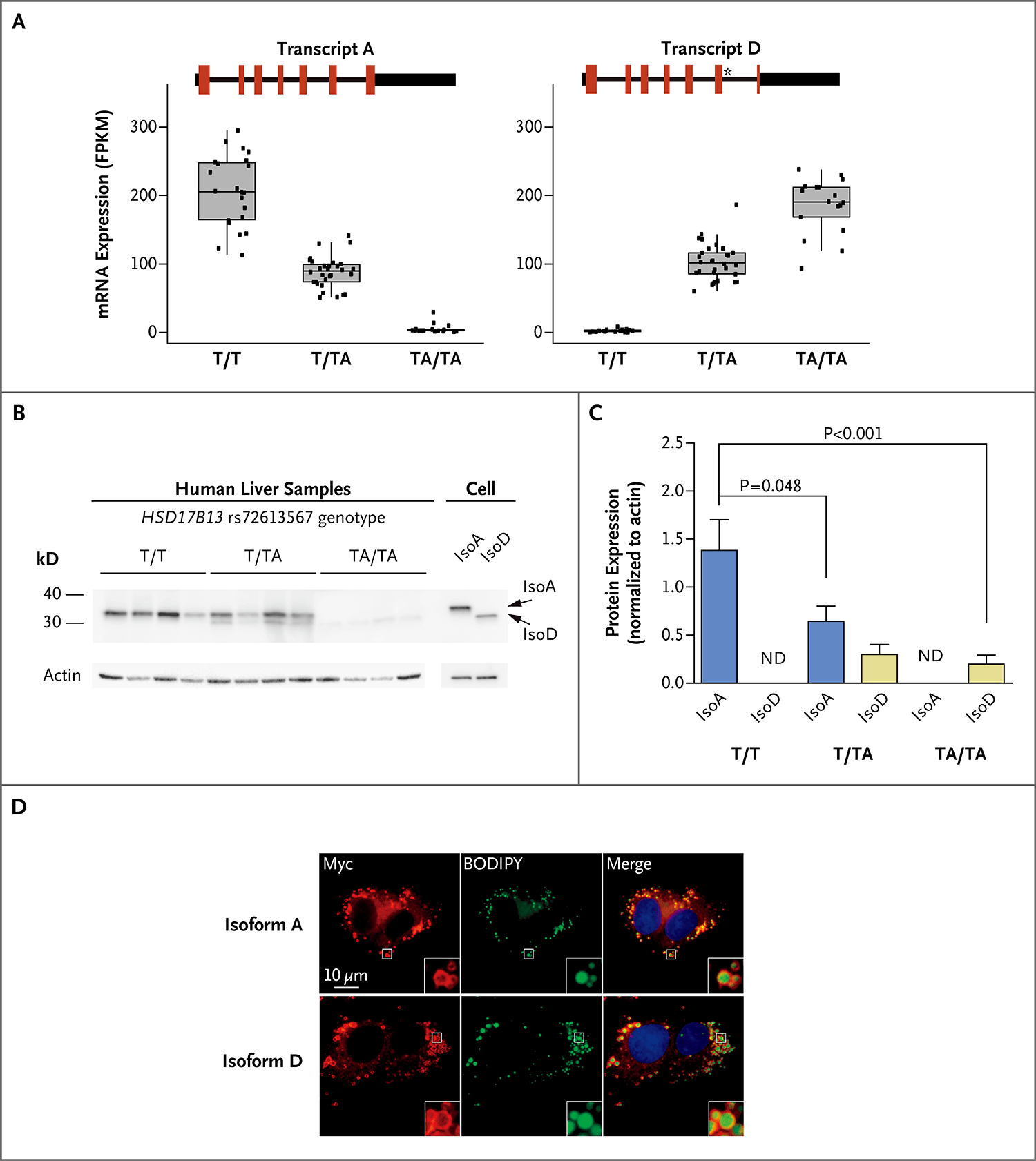 一种产生截短蛋白的HSD17B13变异体对慢性肝病的预防作用 - NEJM医学前沿