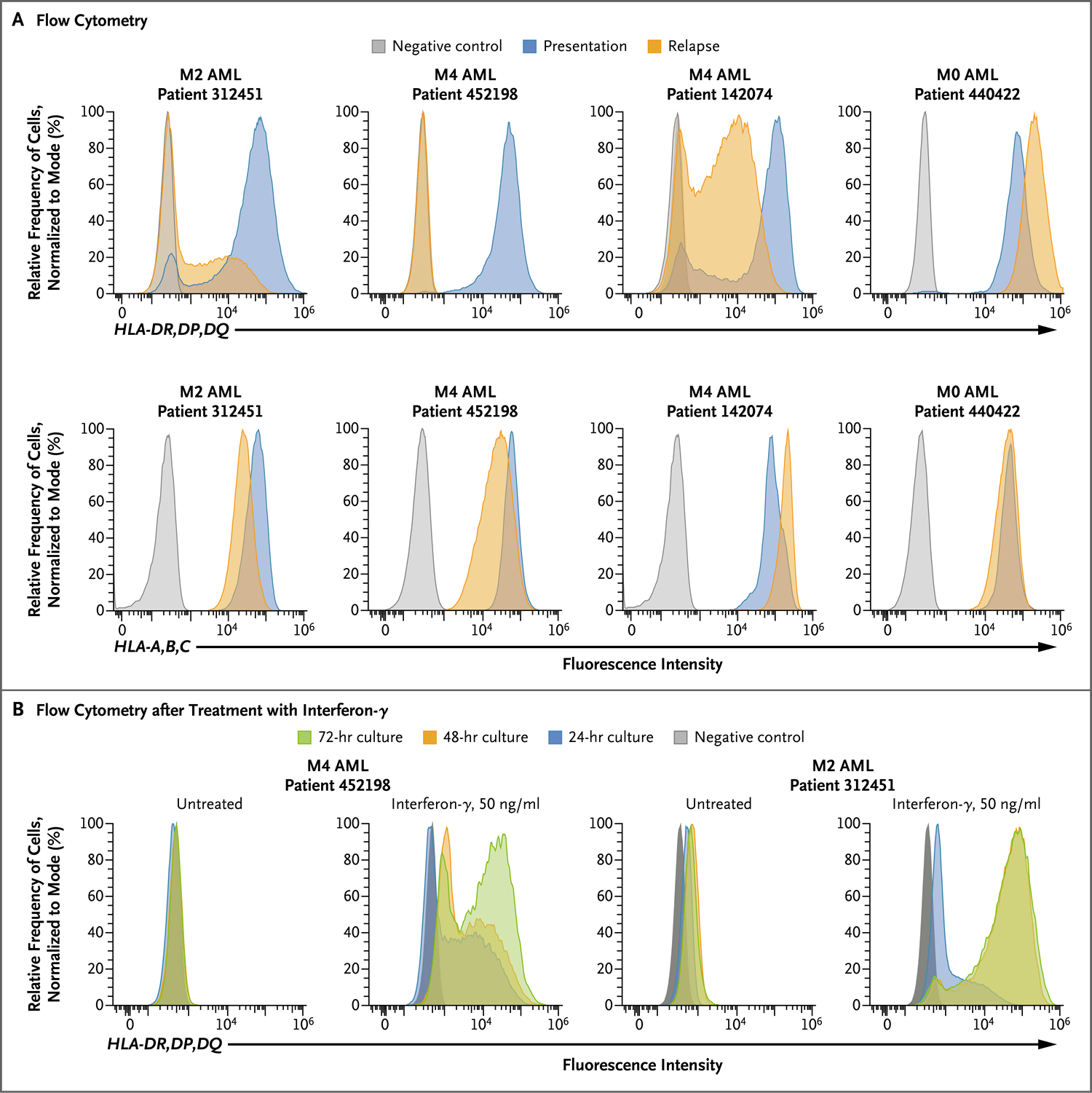异基因移植后复发AML细胞的免疫逃逸 - NEJM医学前沿