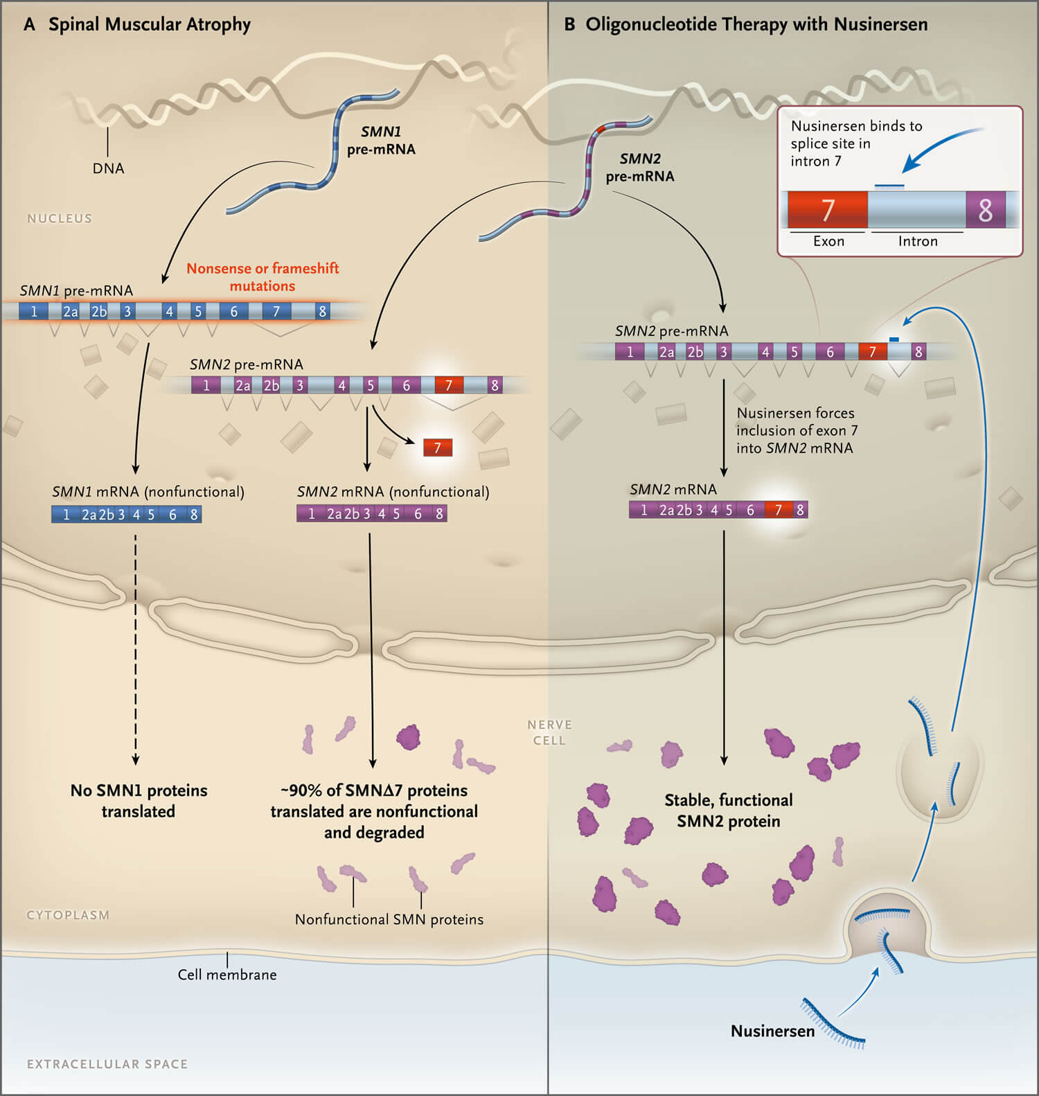使用寡核苷酸在RNA水平治疗疾病 - NEJM医学前沿